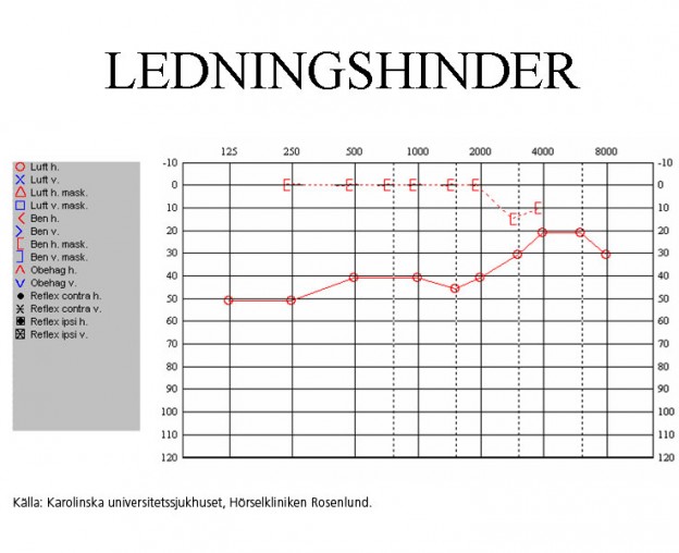 Audiogram - tolkning av audiometri - Distriktsläkare.com